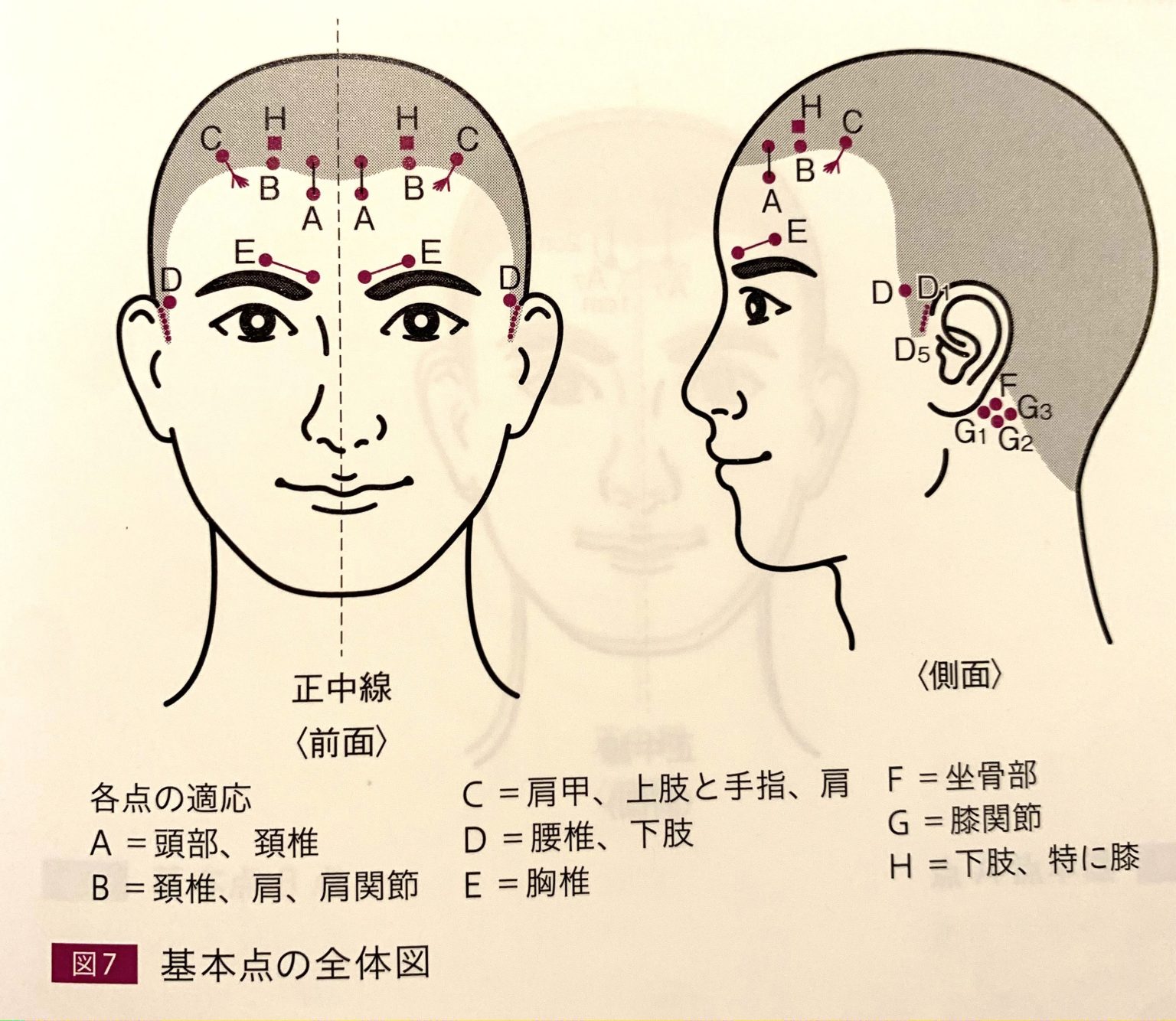 【書籍紹介記事】世界が認めたその効果！「YNSA症例集 山元式新頭鍼療法実践ガイド」 | 医道の日本社（公式サイト）～鍼灸、漢方、マッサージ ...